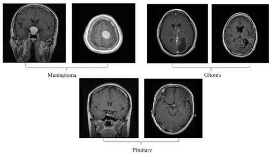 Diagnostics | Free Full-Text | Grade Classification of Tumors from ...