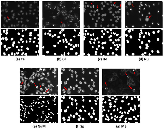 Deep Active Learning for Automatic Mitotic Cell Detection on HEp-2 Specimen Medical Images