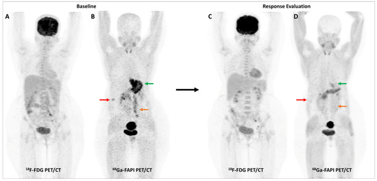 Diagnostics | Special Issue : Advances in PET/CT Imaging