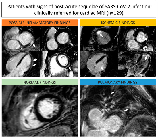 Cardiac MRI Findings in Patients Clinically Referred for Evaluation of ...