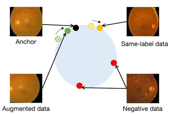 Supervised Contrastive Learning with Angular Margin for the Detection ...
