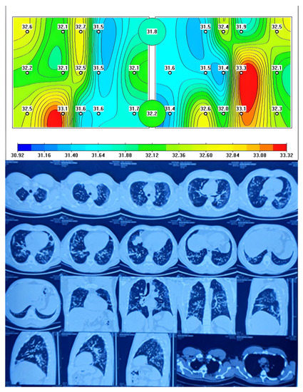 Diagnostics | Special Issue : Medical Microwave Radiometry for R&D and ...