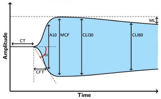 Basic Principles of Rotational Thromboelastometry (ROTEM®) and the Role ...