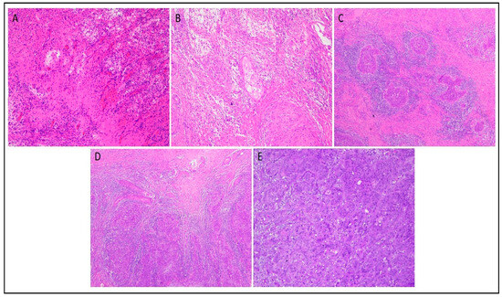 Prognostic Value of Mandard’s Tumor Regression Grade (TRG) in Post ...