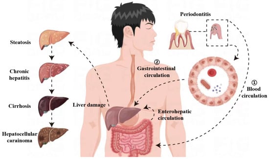 Oral Pathogenic Bacteria and the Oral–Gut–Liver Axis: A New ...