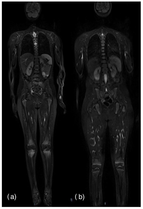 Diagnostics | Free Full-Text | Machine Learning Algorithm: Texture Analysis in CNO and ...