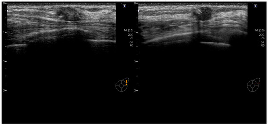 Diagnostics | An Open Access Journal from MDPI