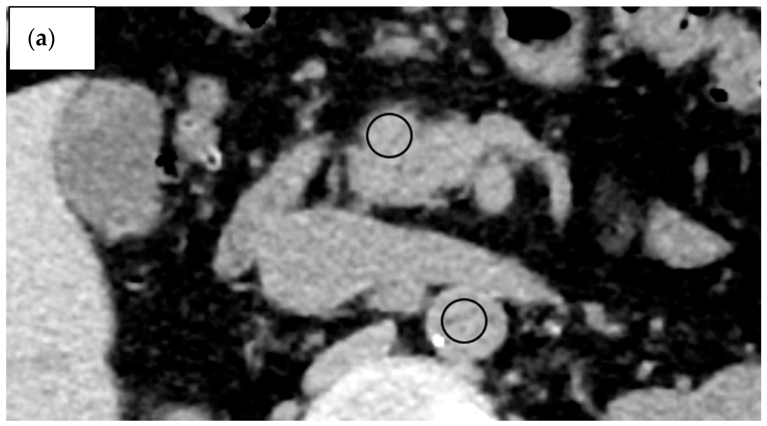 Effective Extracellular Volume Fraction Determined by Equilibrium ...