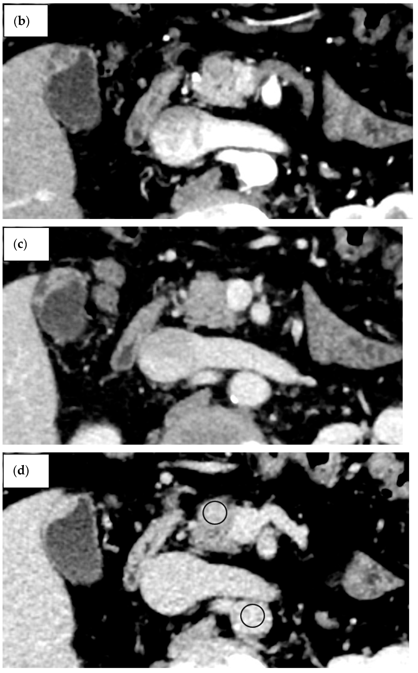 Effective Extracellular Volume Fraction Determined by Equilibrium ...
