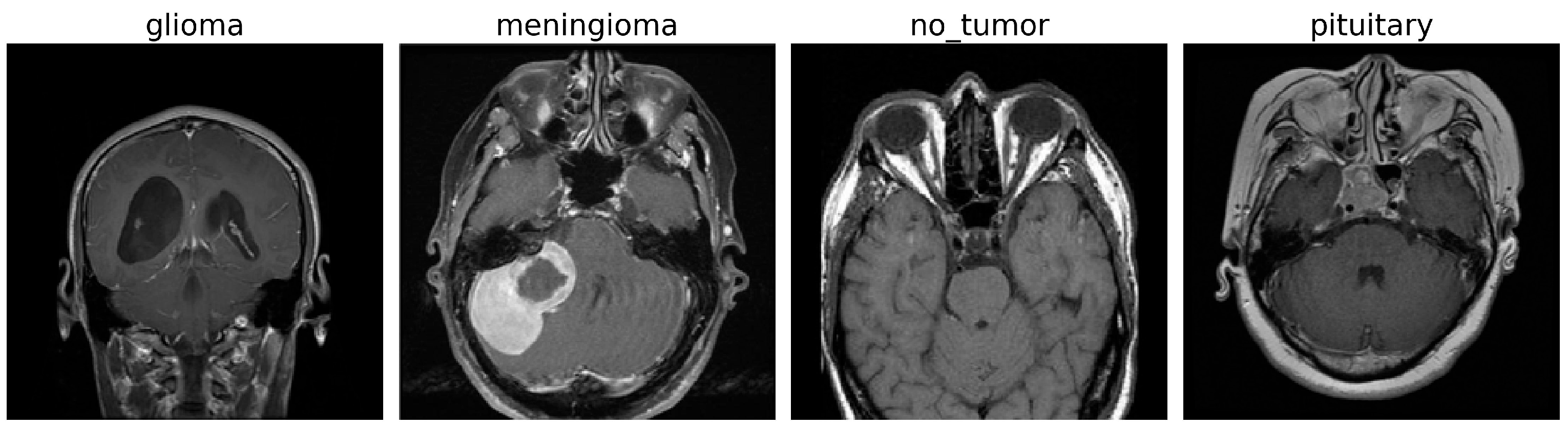 Role of Feature Diversity in the Performance of Hybrid Models—An ...