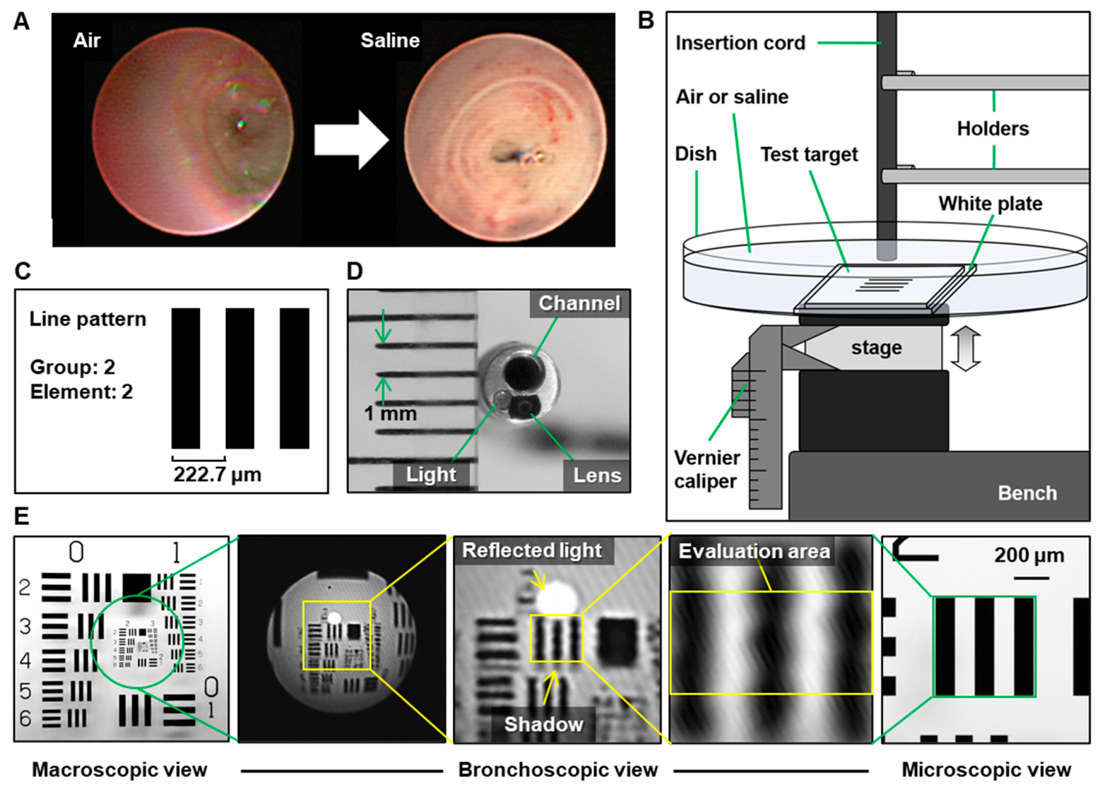 Bronchial Physiological Saline Injection to Visualize Peripheral ...