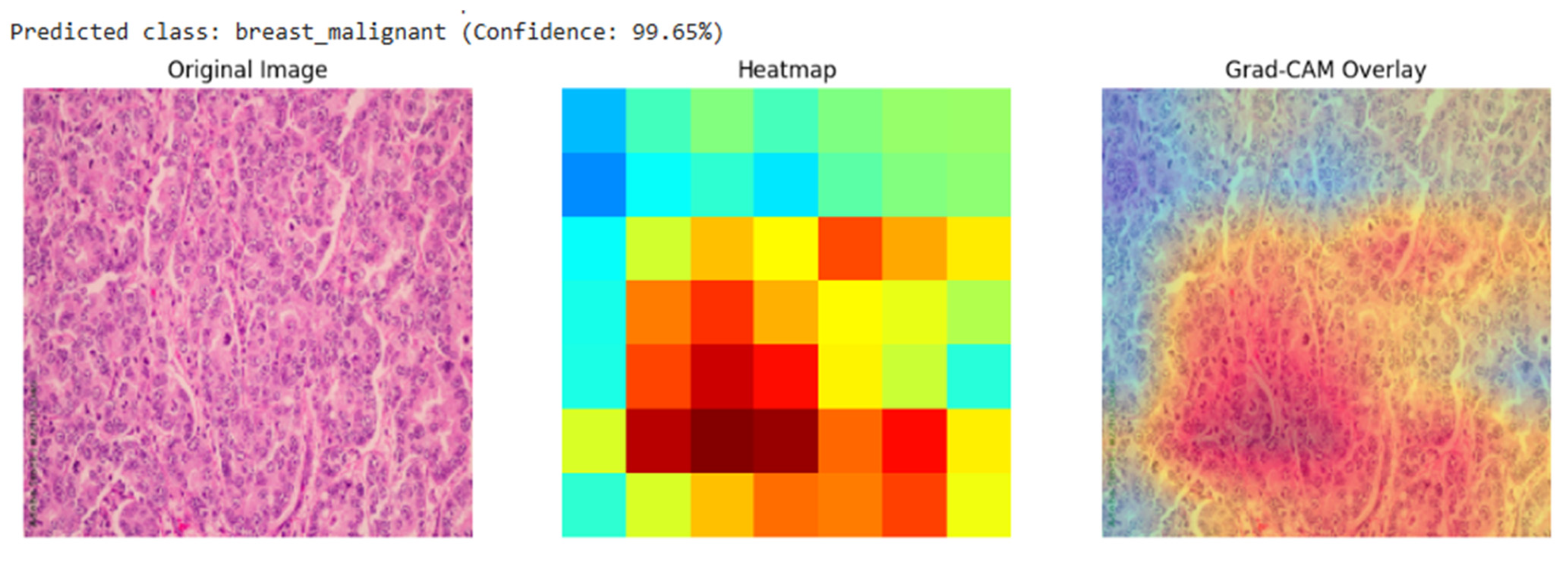 Browser-Based Multi-Cancer Classification Framework Using Depthwise ...