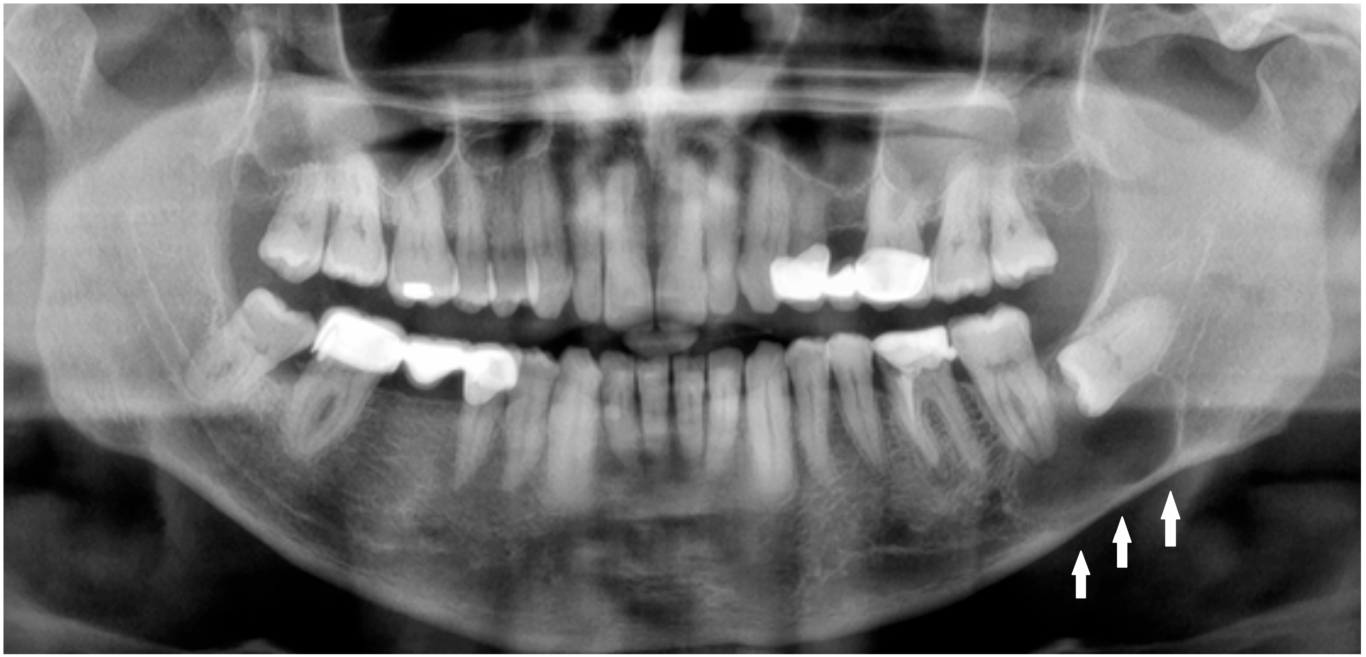 When CBCT Looks Borderline and Standard Radiology Is Inconclusive ...