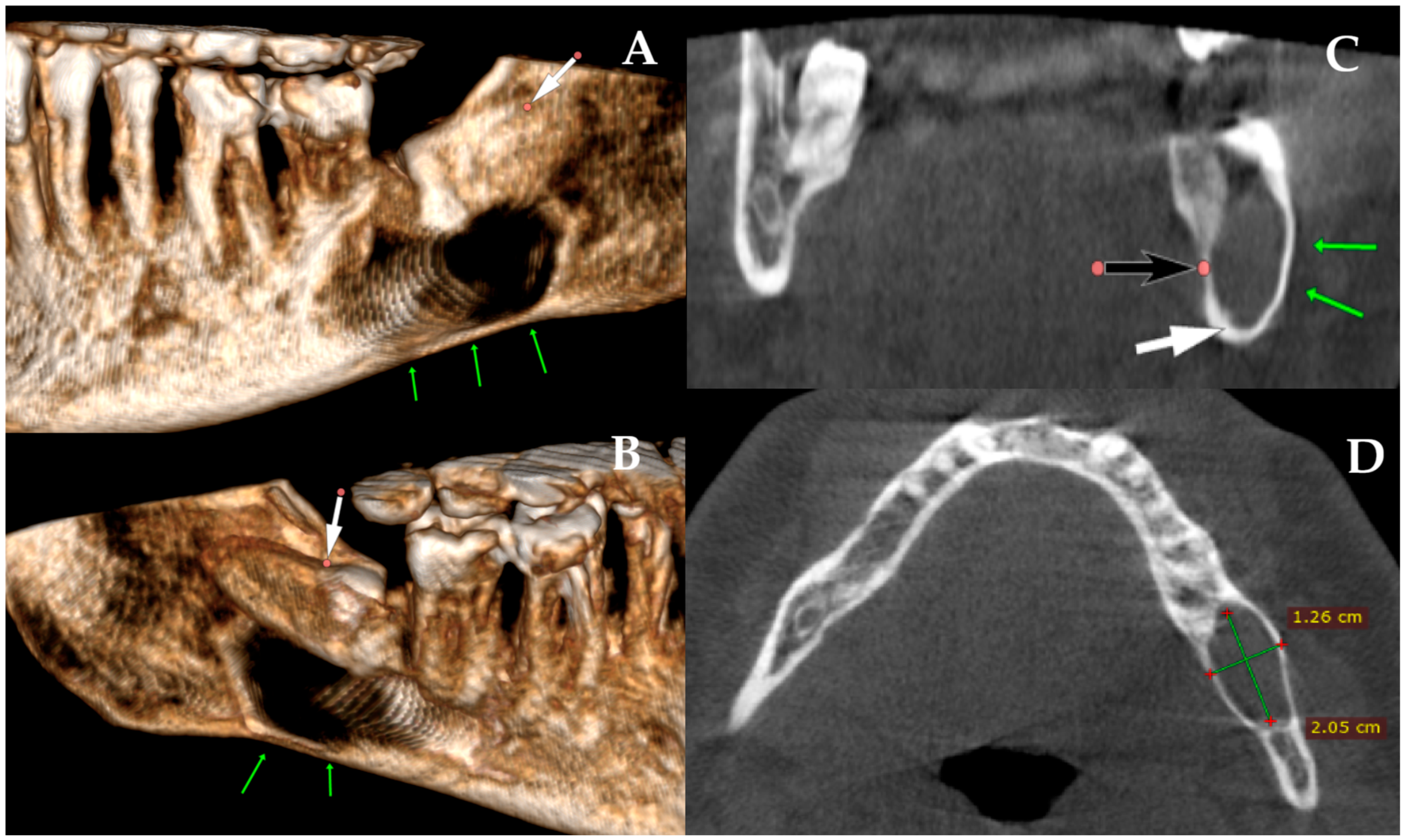 When CBCT Looks Borderline and Standard Radiology Is Inconclusive ...