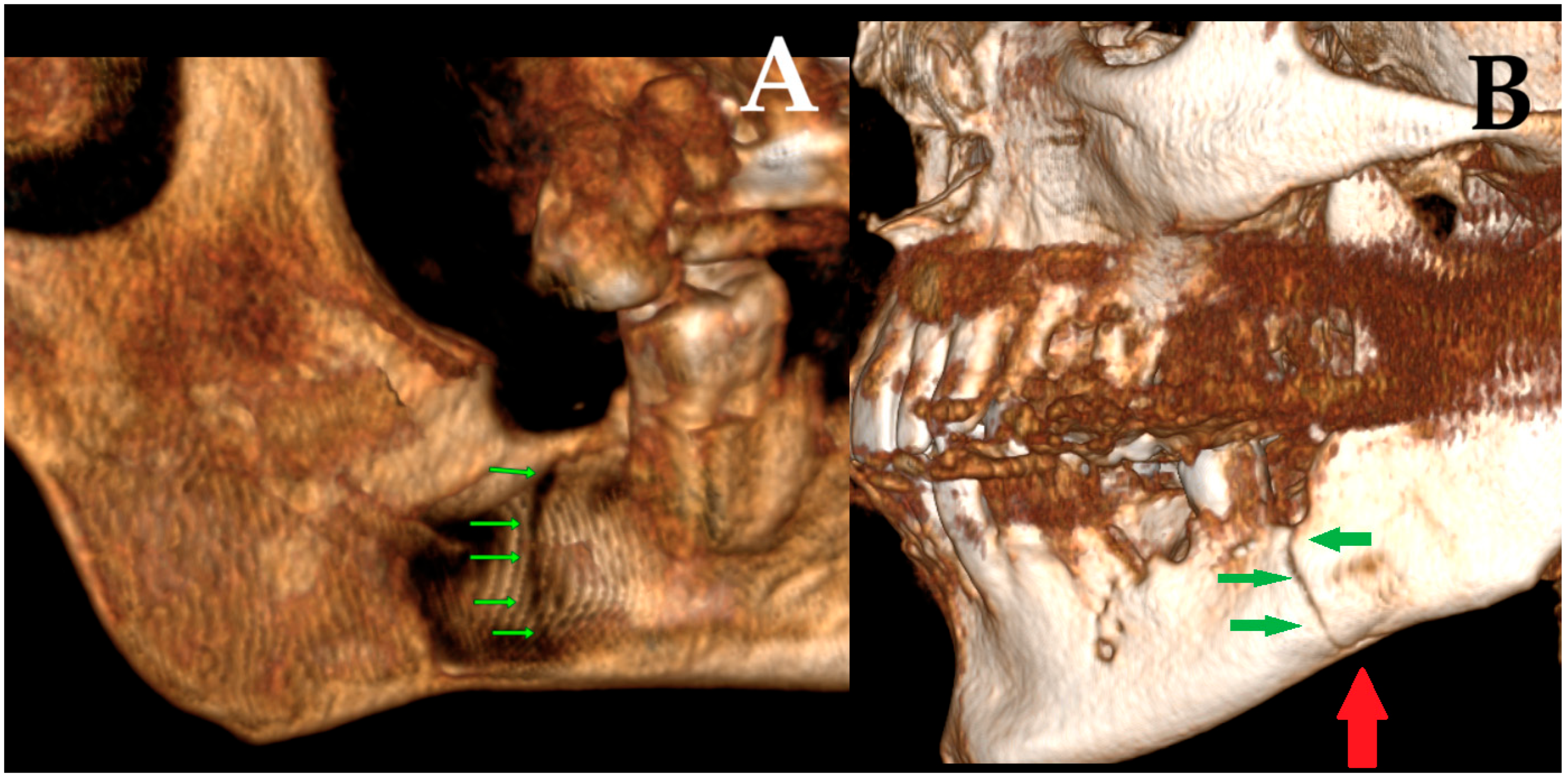 When CBCT Looks Borderline and Standard Radiology Is Inconclusive ...