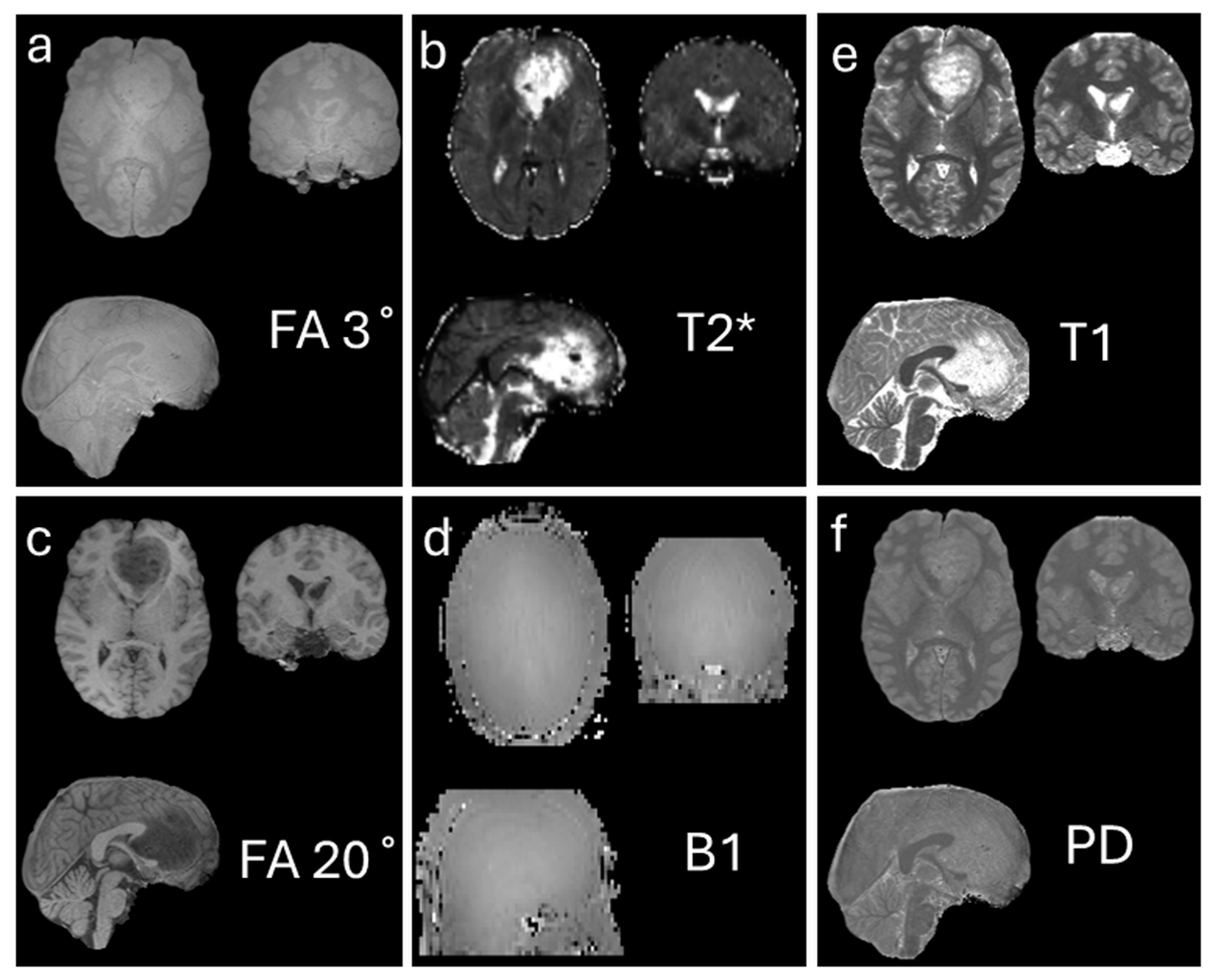 Functional, Structural, and AI-Based MRI Analysis: A Comprehensive ...