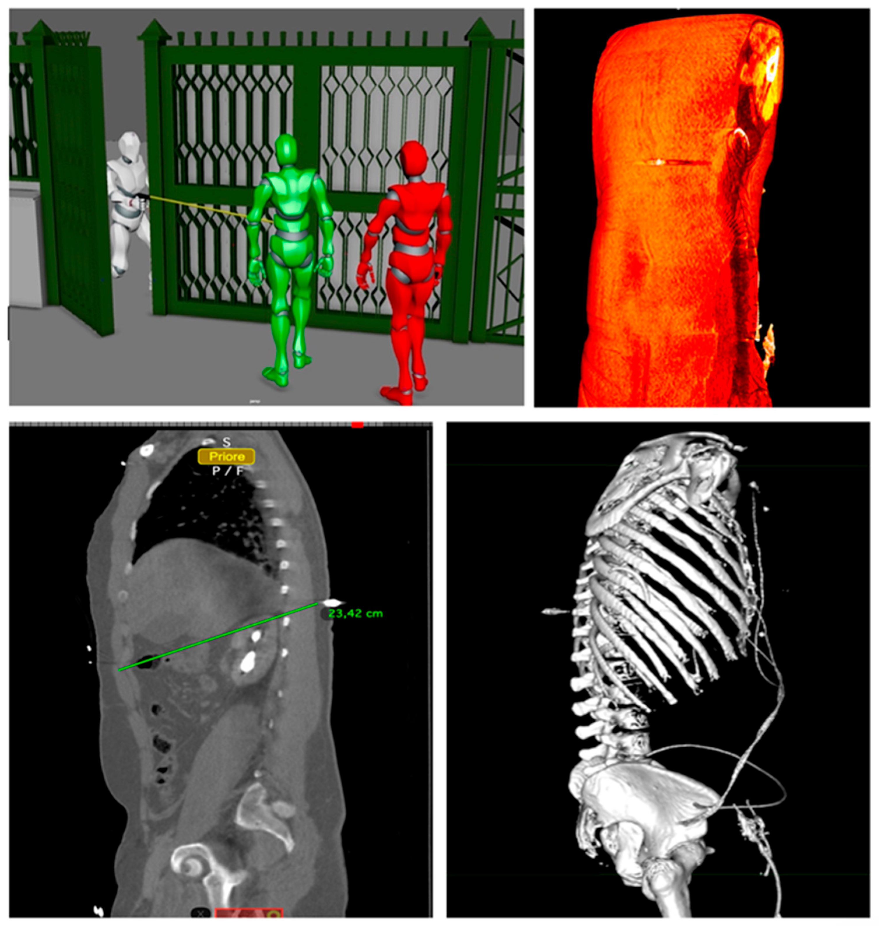 A Diagnostic Algorithm for Reconstructing the Direction of Gunshots ...