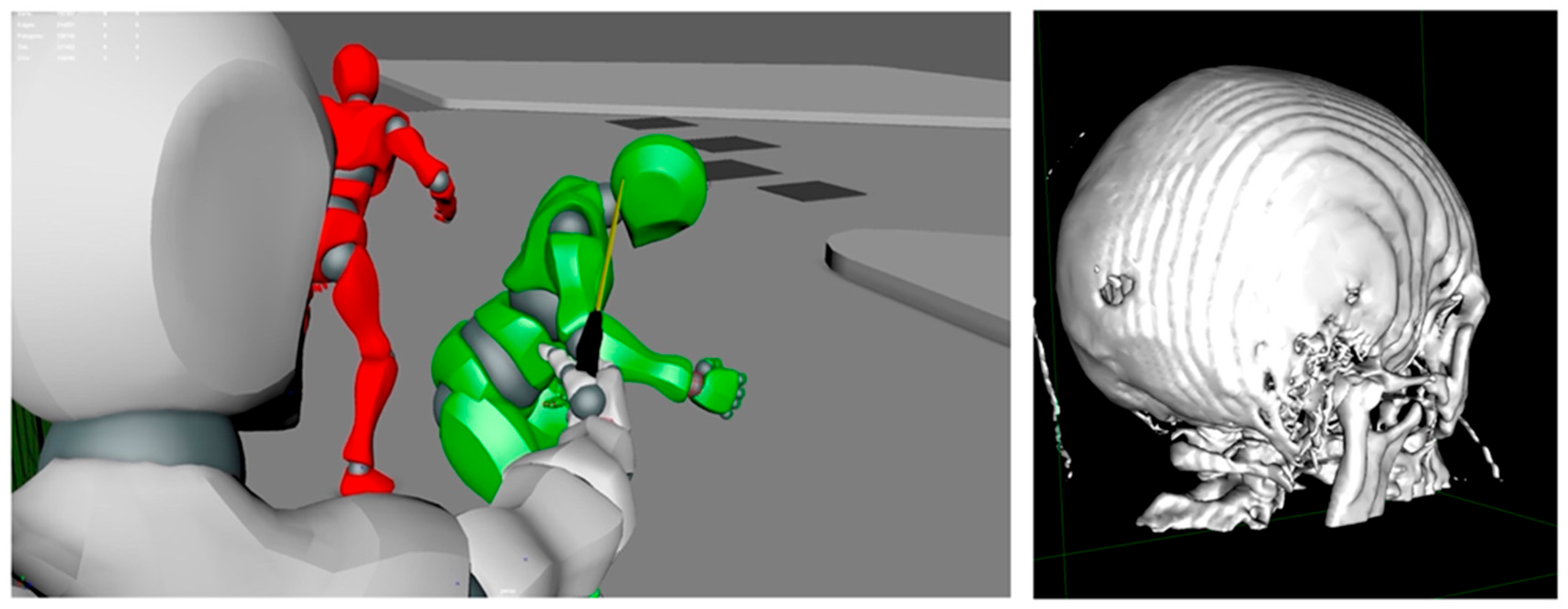 A Diagnostic Algorithm for Reconstructing the Direction of Gunshots ...