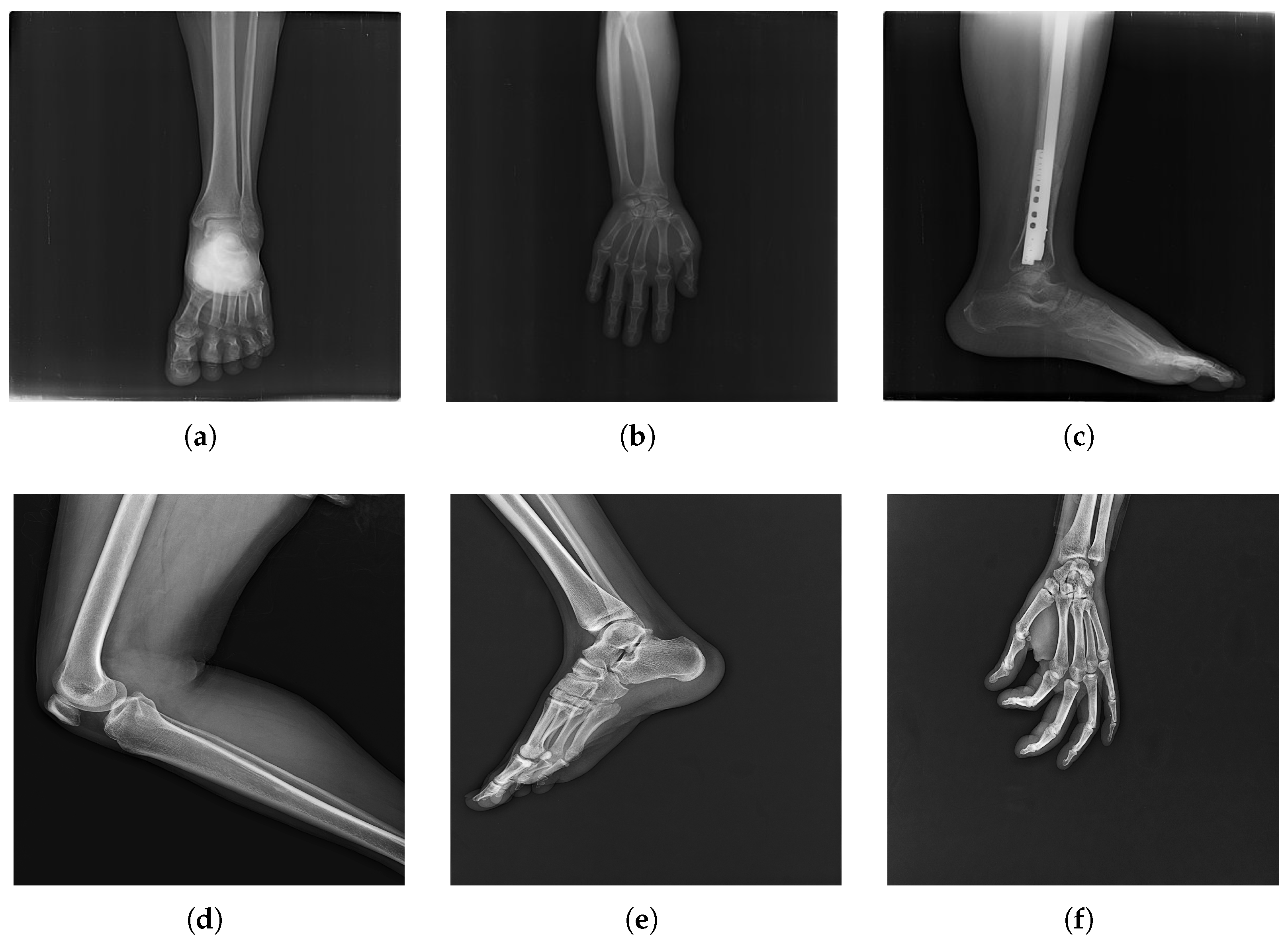 An Interpretable Hybrid SFNet Deep Learning Framework for Multi-Site ...