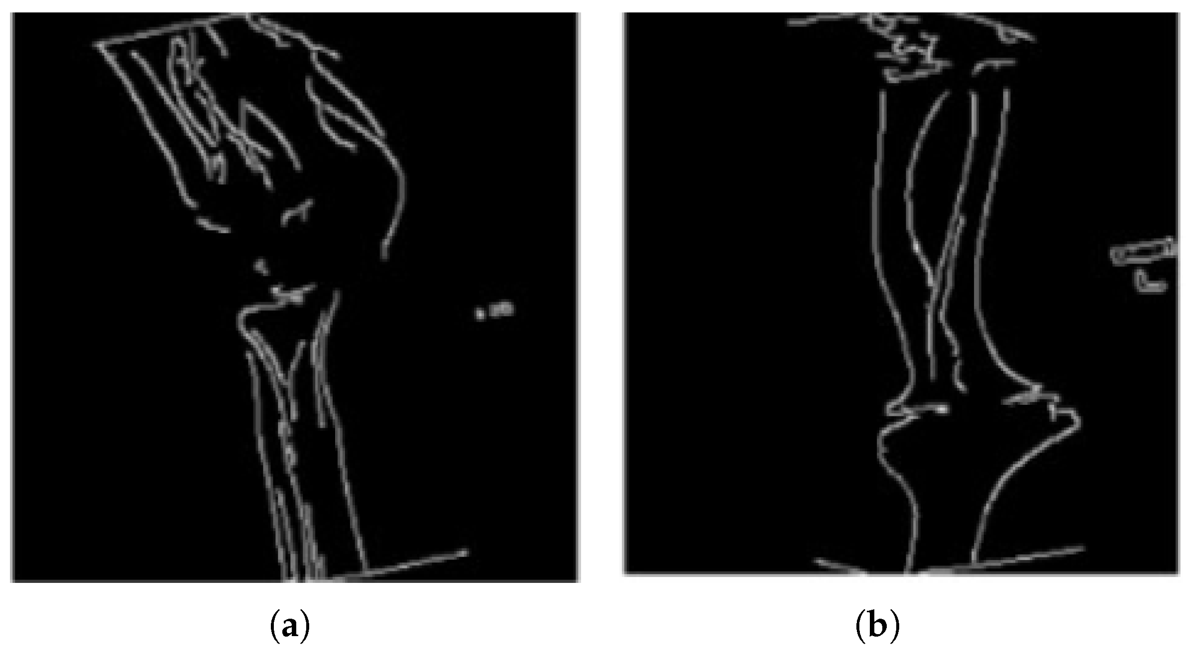 An Interpretable Hybrid SFNet Deep Learning Framework for Multi-Site ...