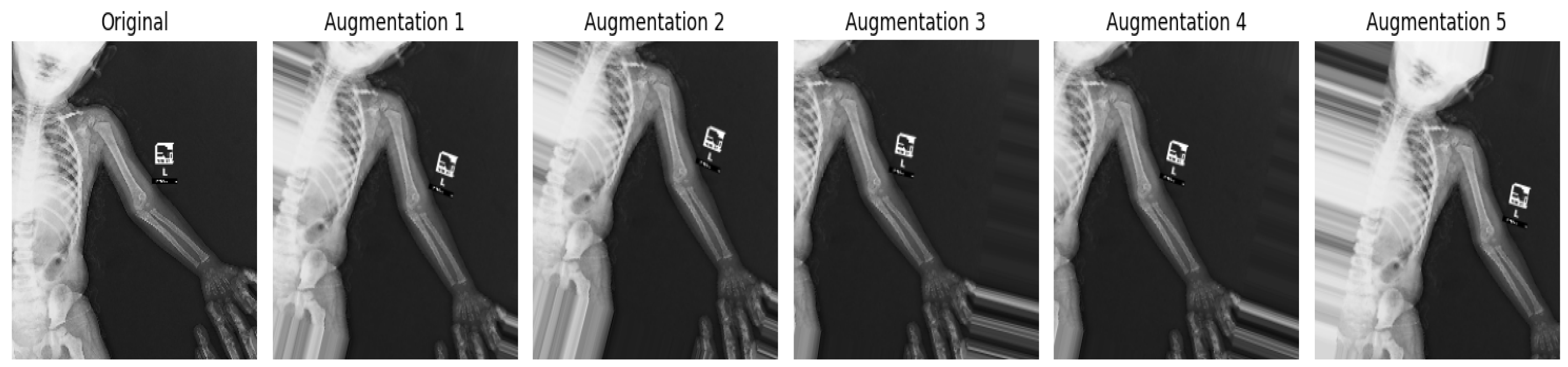 An Interpretable Hybrid SFNet Deep Learning Framework for Multi-Site ...