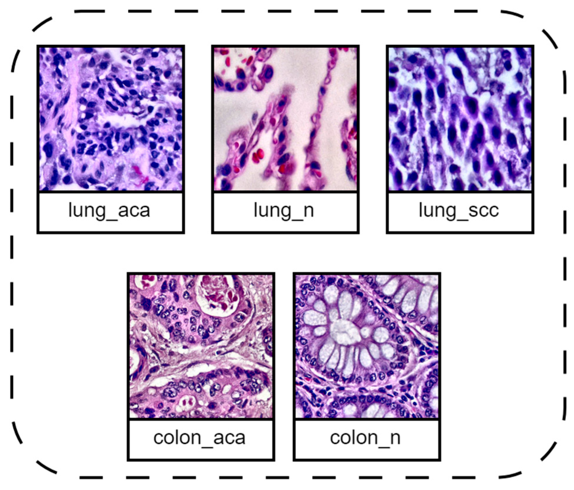 A Hybrid Lung and Colon Histopathological Image Classification ...