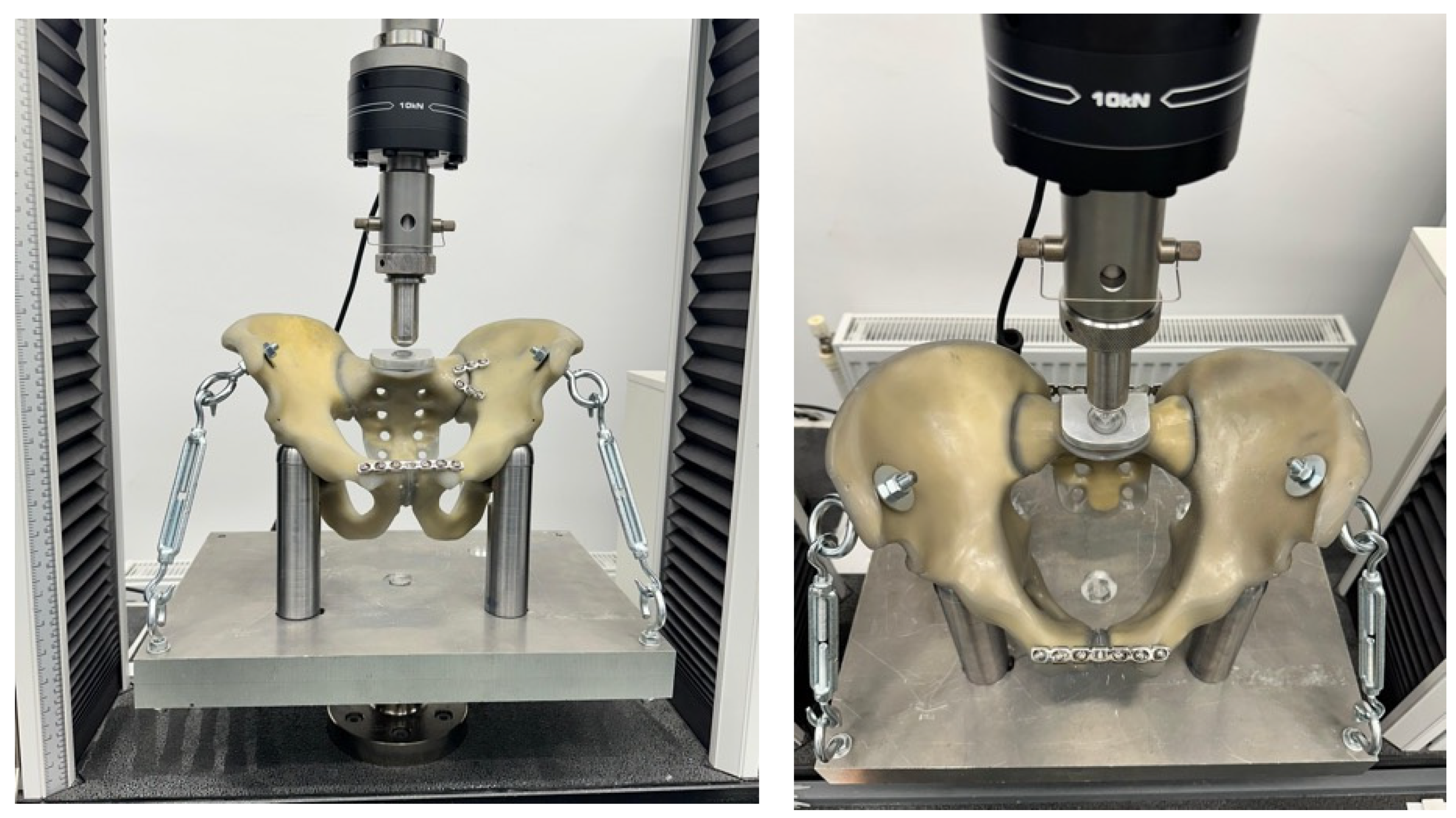 Exploratory Biomechanical Comparison of Three Posterior Pelvic Ring ...