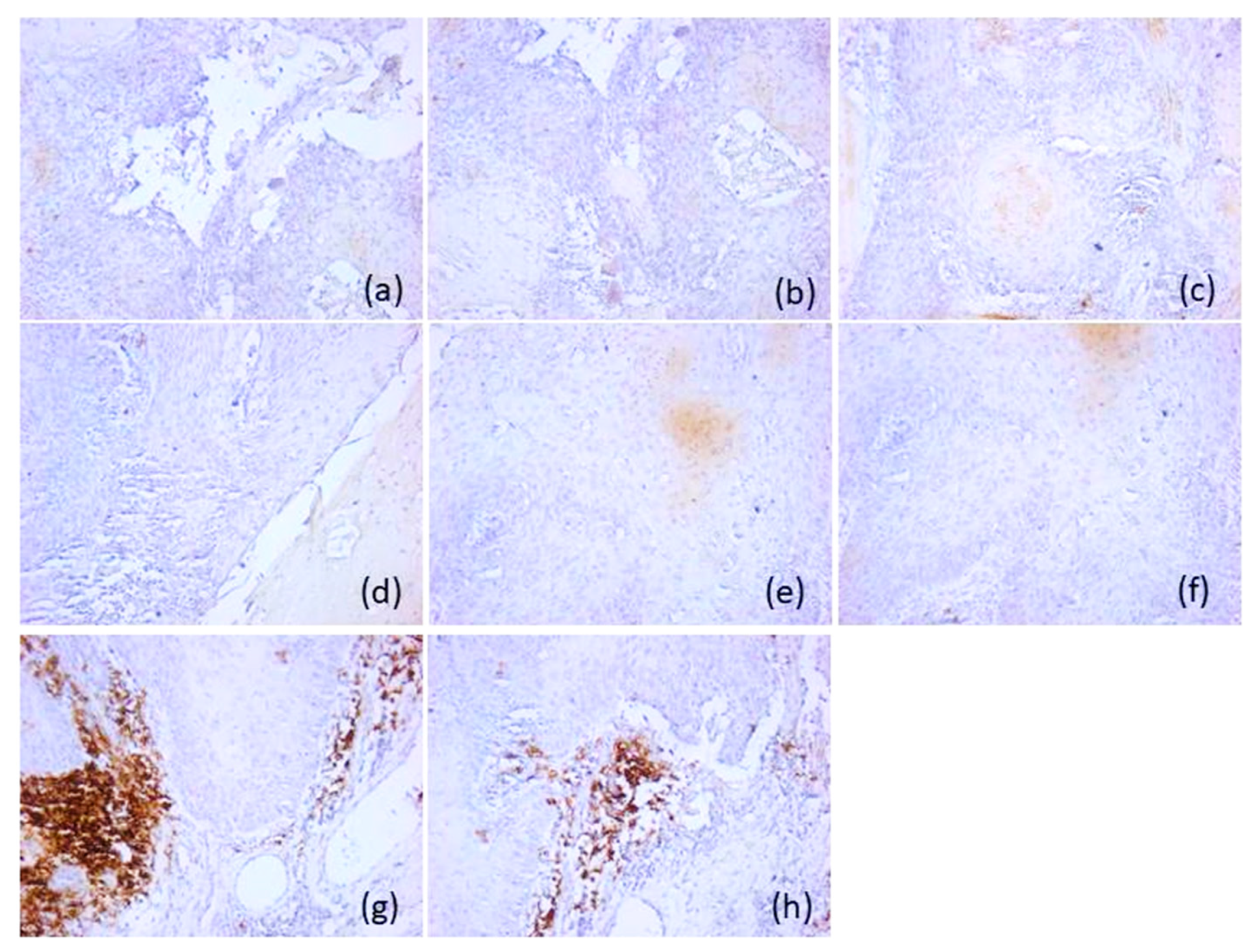 Immunohistochemical Study of the Tumor Immune Microenvironment in p16 ...