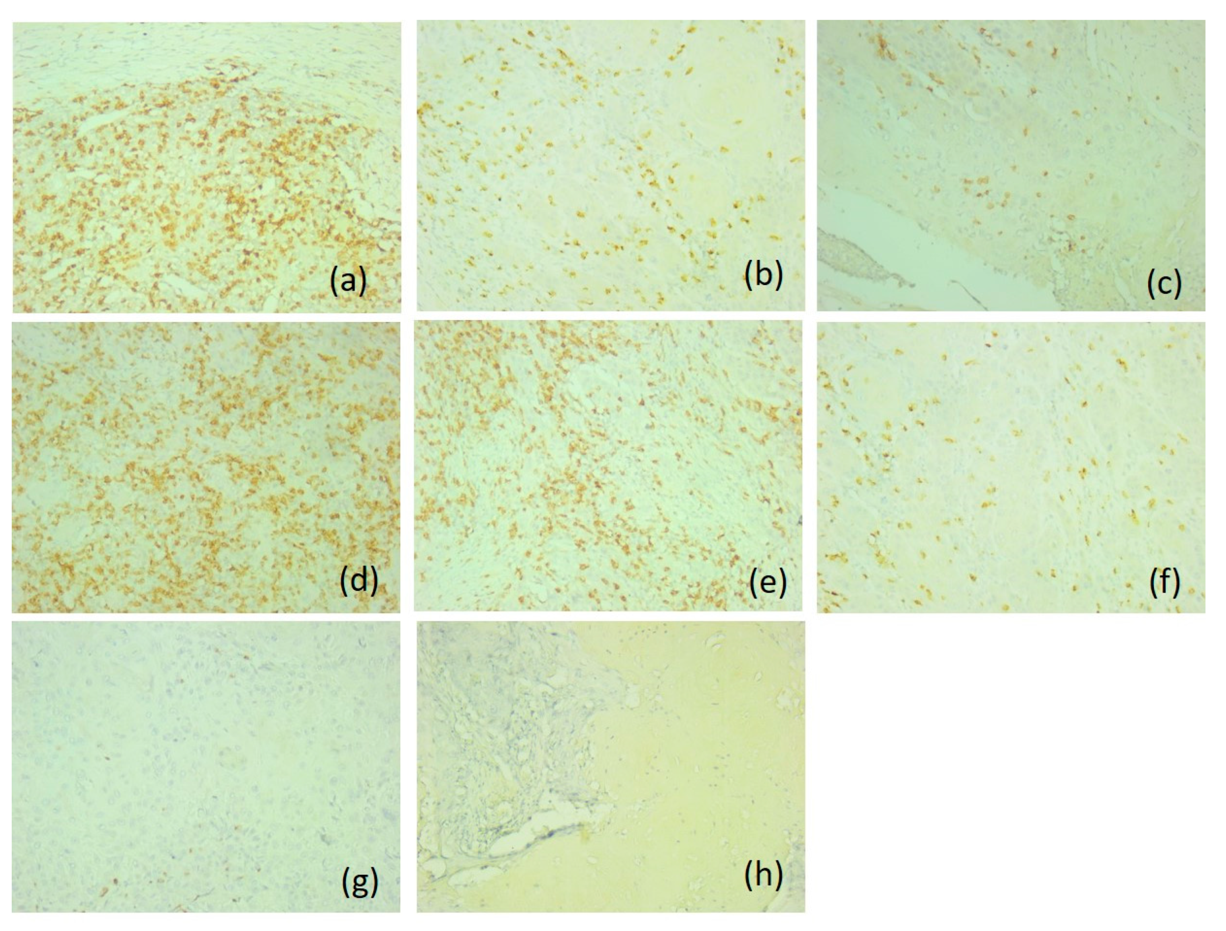 Immunohistochemical Study of the Tumor Immune Microenvironment in p16 ...