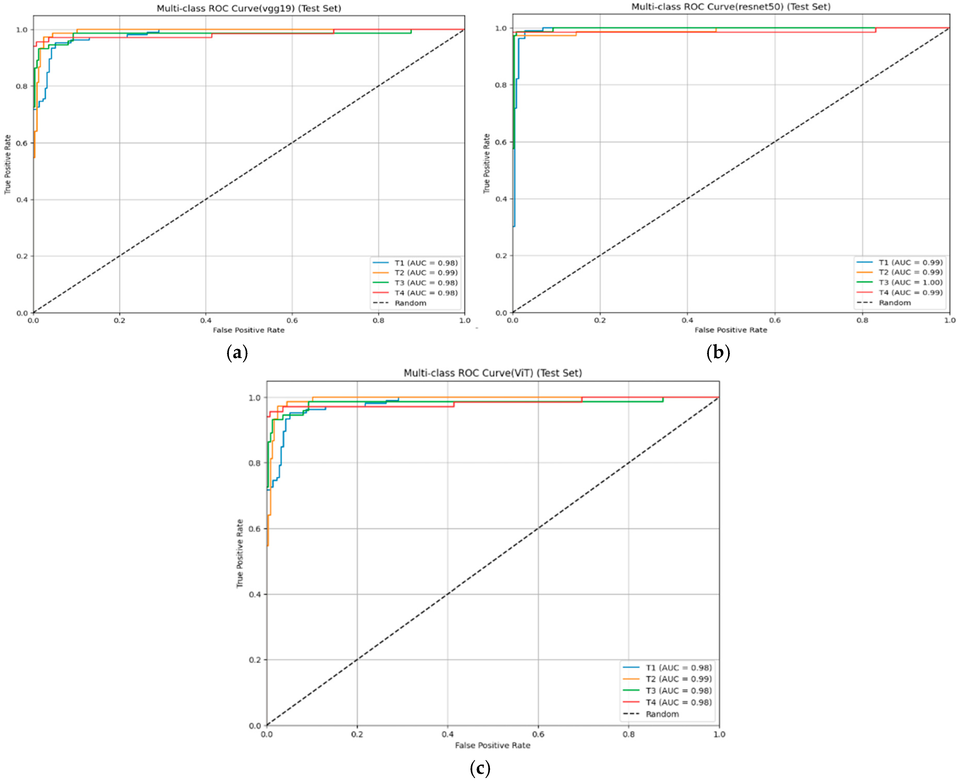 MRI-Based Bladder Cancer Staging via YOLOv11 Segmentation and Deep ...