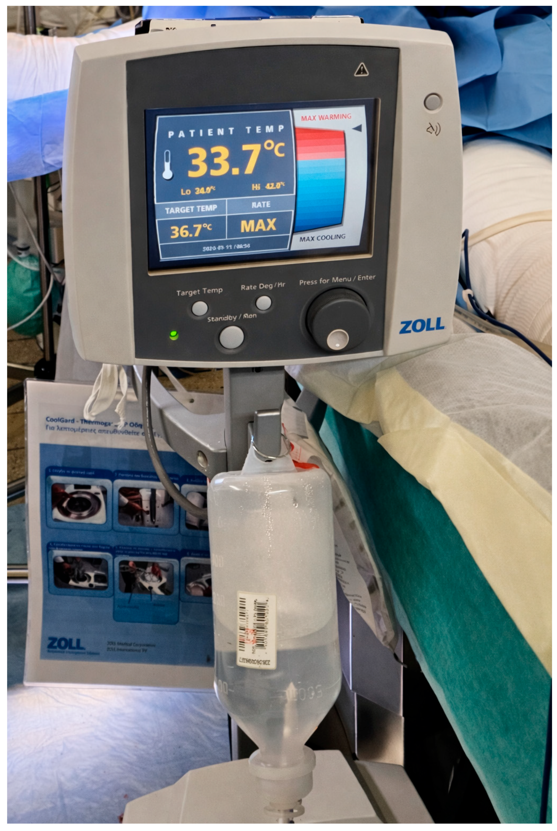 Intravascular Rewarming in Major Burns: A Rare but Serious Catheter ...