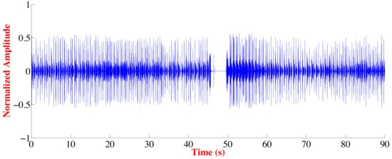 Electronics | Free Full-Text | An EMD-Based Algorithm for Emboli Detection in Echo Doppler Audio ...