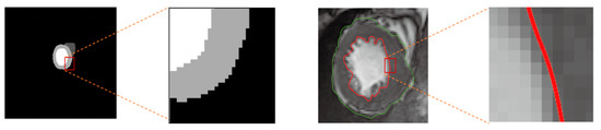An Improved Level Set Algorithm Based on Prior Information for Left ...