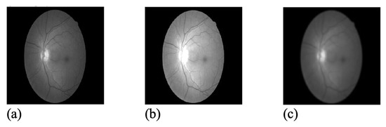Electronics | Free Full-Text | Segmentation of Retinal Blood Vessels ...