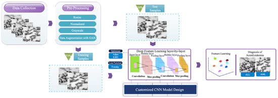 A Customized Efficient Deep Learning Model for the Diagnosis of Acute ...