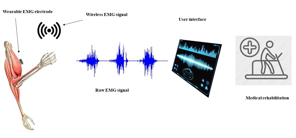Electromyography Monitoring Systems In Rehabilitation A Review Of Electromyography Monitoring Systems In Rehabilitation A Review Of
