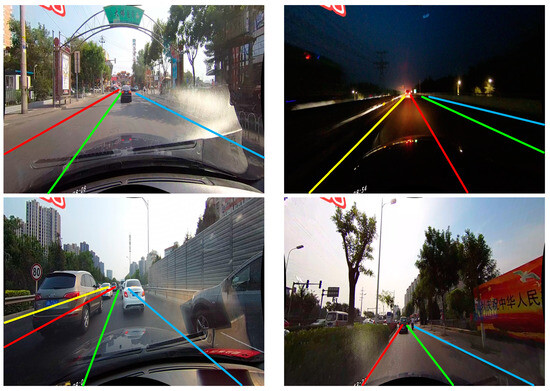 Electronics | Free Full-Text | A Faster and Lightweight Lane Detection ...