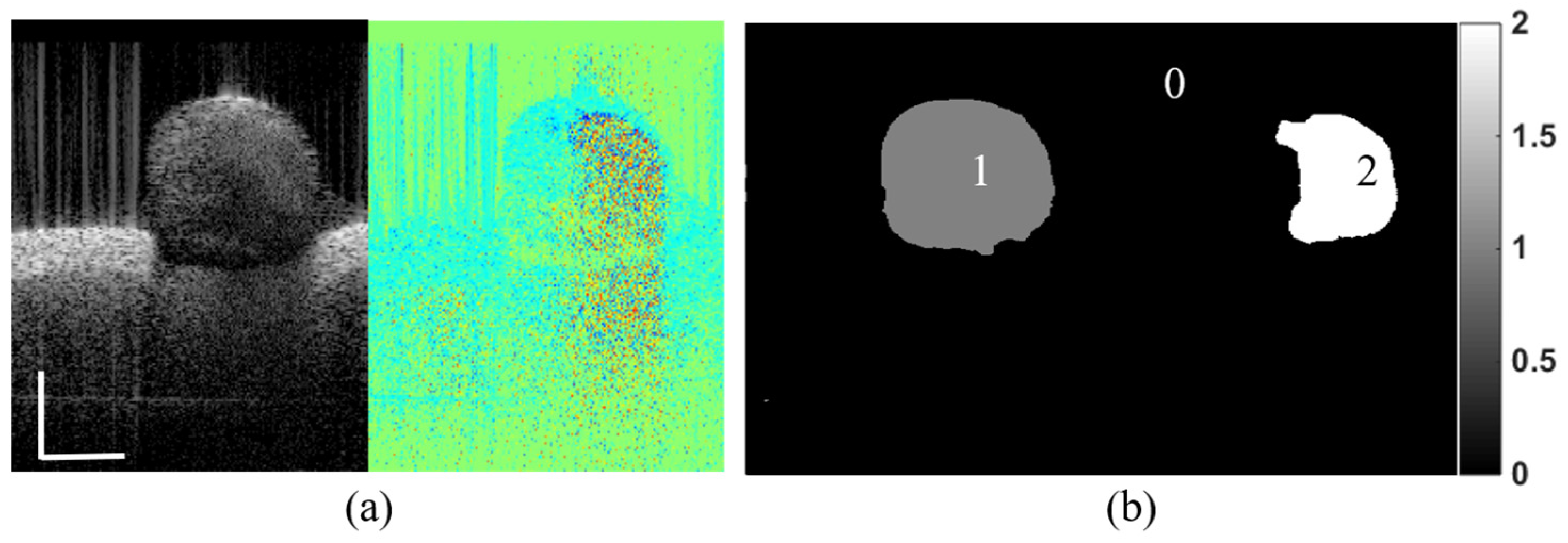 Boundary Segmentation of Vascular Images in Fourier Domain Doppler ...