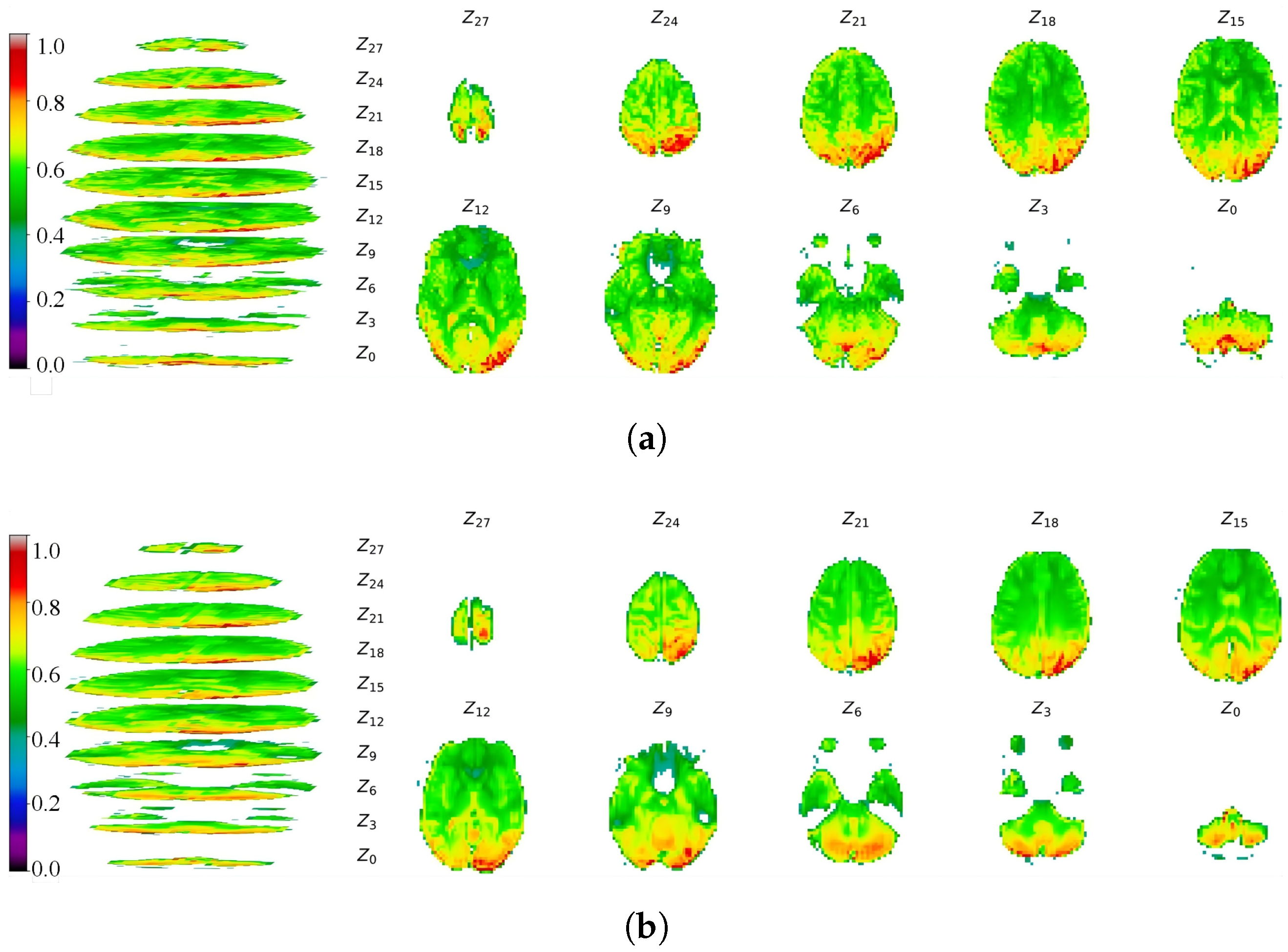 Research on fMRI Image Generation from EEG Signals Based on Diffusion Models