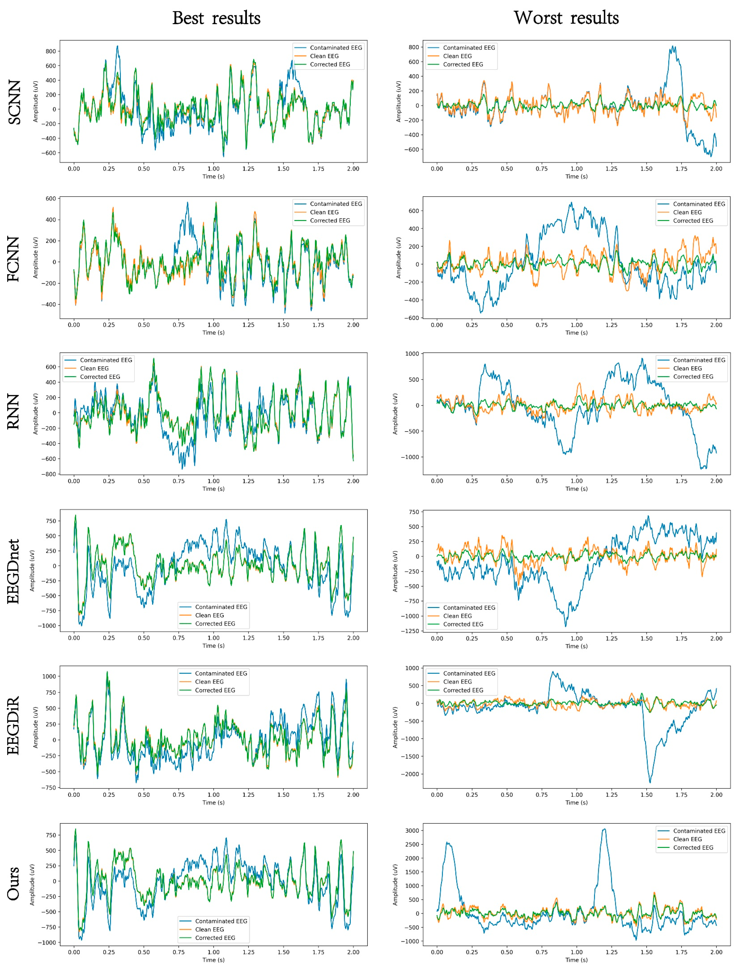 TF-Denoiser: A Time-Frequency Domain Joint Method for EEG Artifact Removal