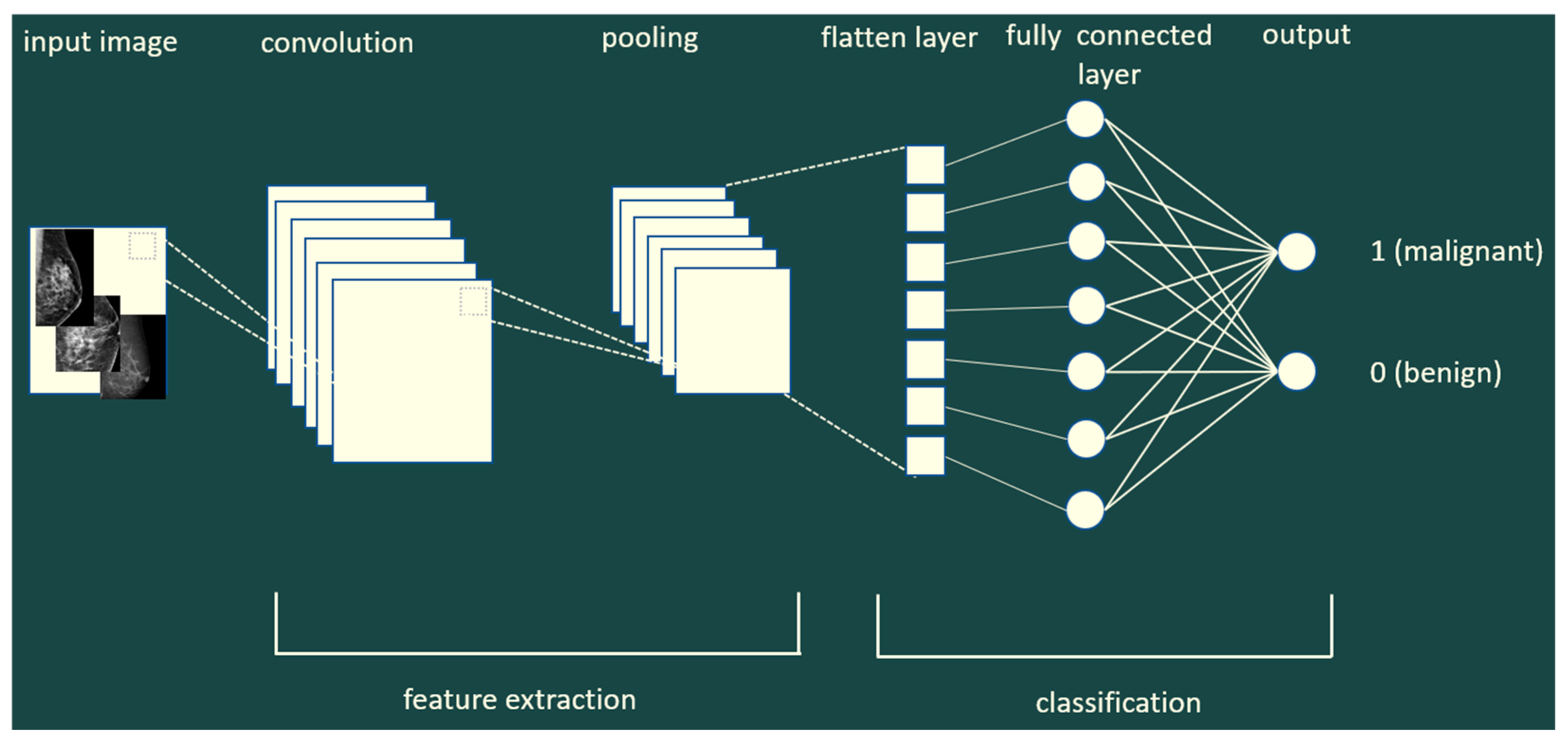 Class-Balanced Convolutional Neural Networks for Digital Mammography ...