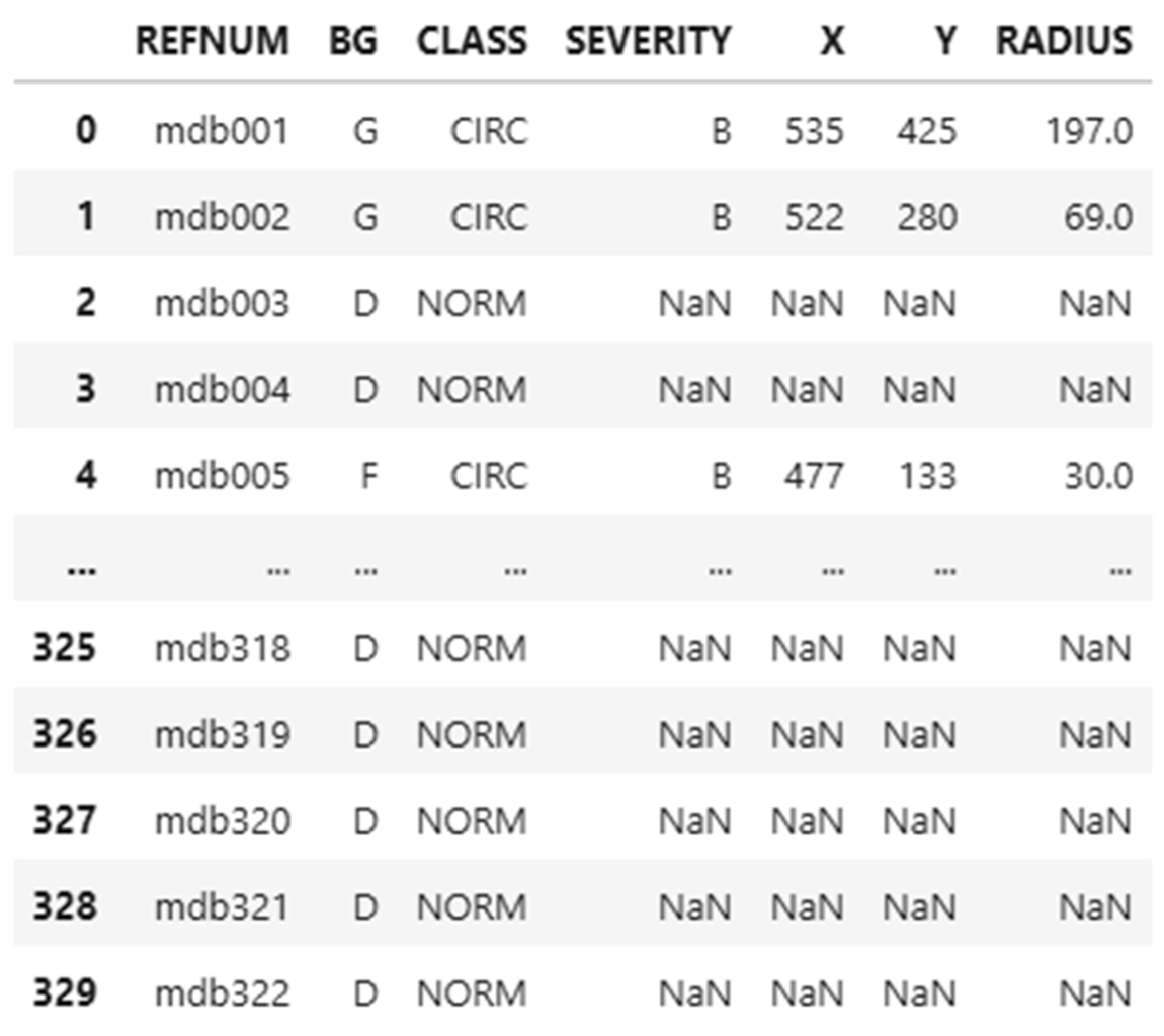 Class-Balanced Convolutional Neural Networks for Digital Mammography ...