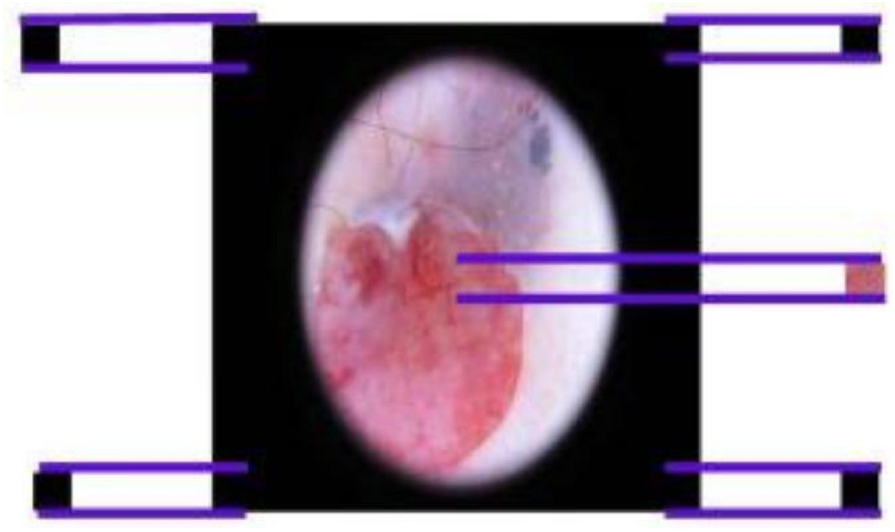 Unmasking Biases and Reliability Concerns in Convolutional Neural ...
