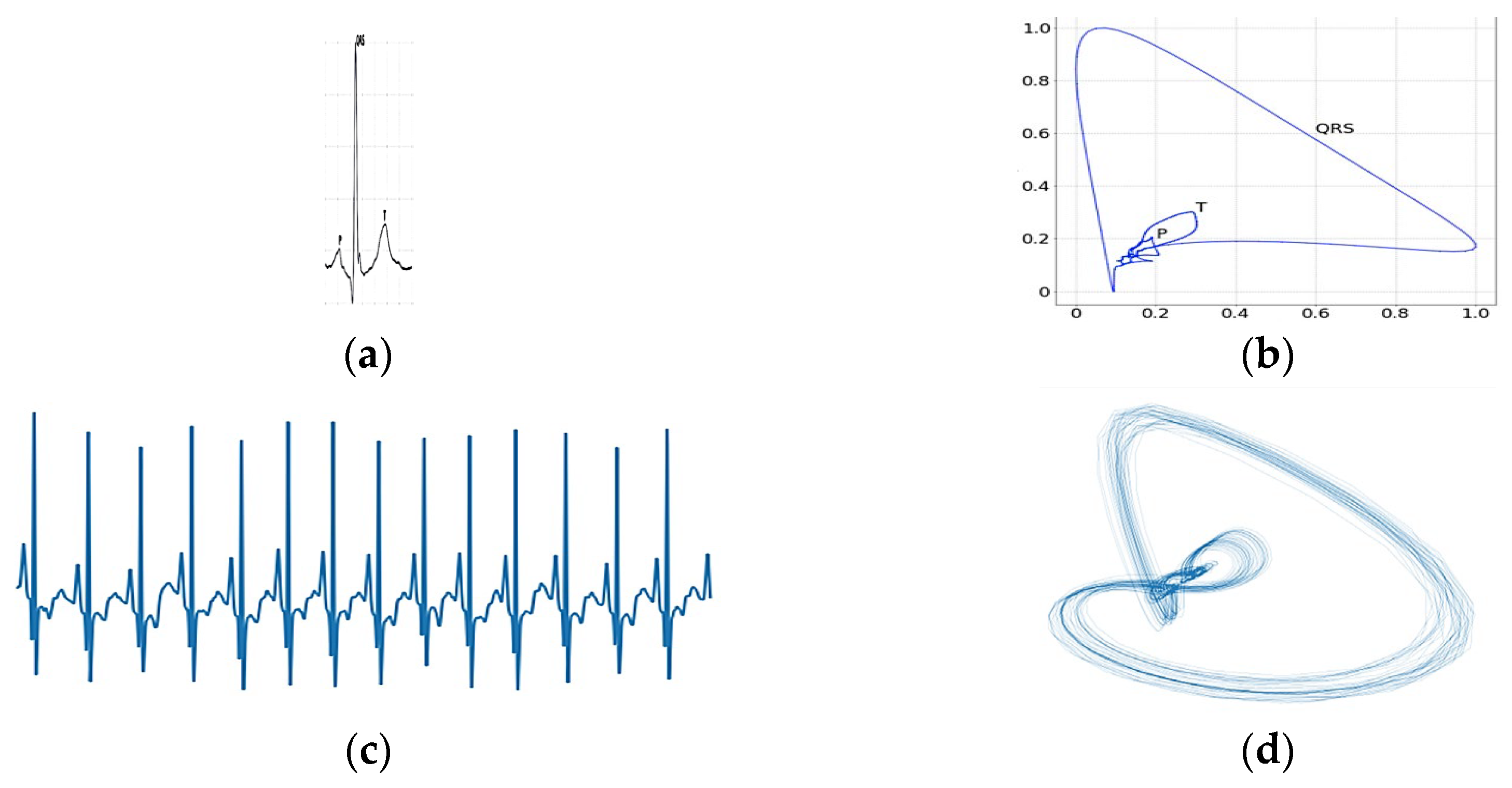 Emotion Recognition Using Electrocardiogram Trajectory Variation in ...