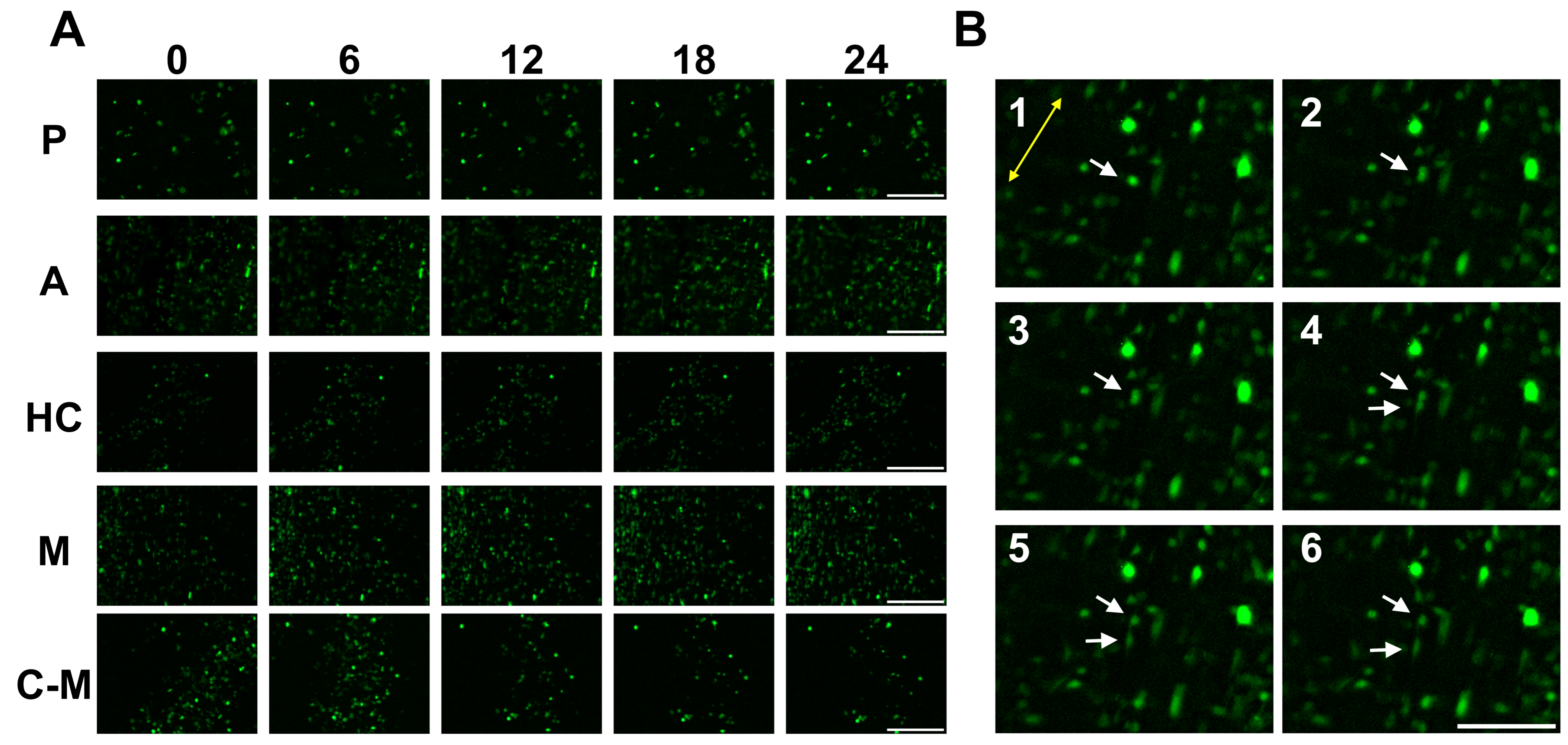 Electrospun Nanofiber Scaffolds for In Vitro 3D Tissue Engineering