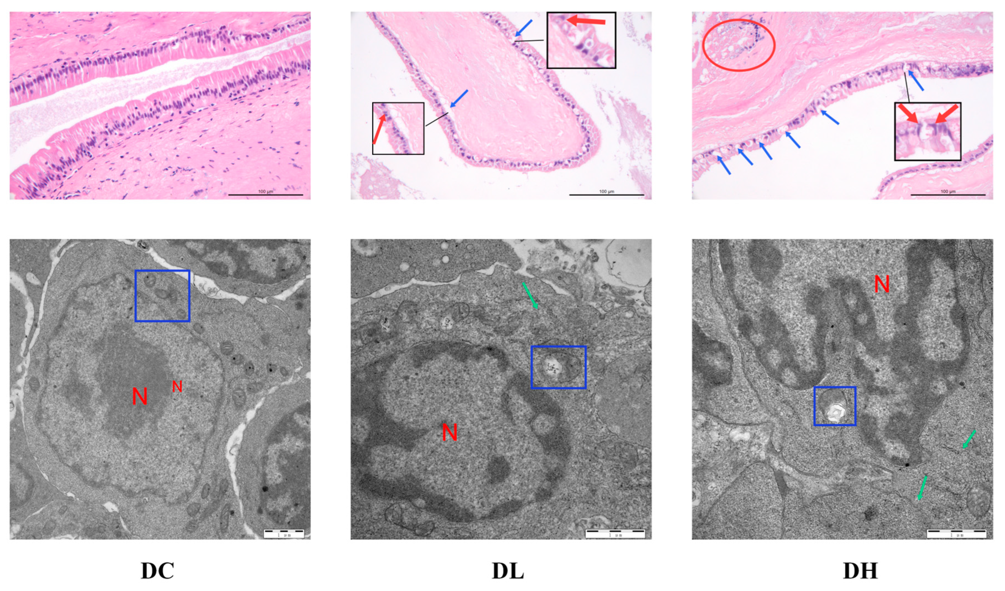Local Mucosal Toxicity and Inflammatory Responses in the Gallbladder of ...