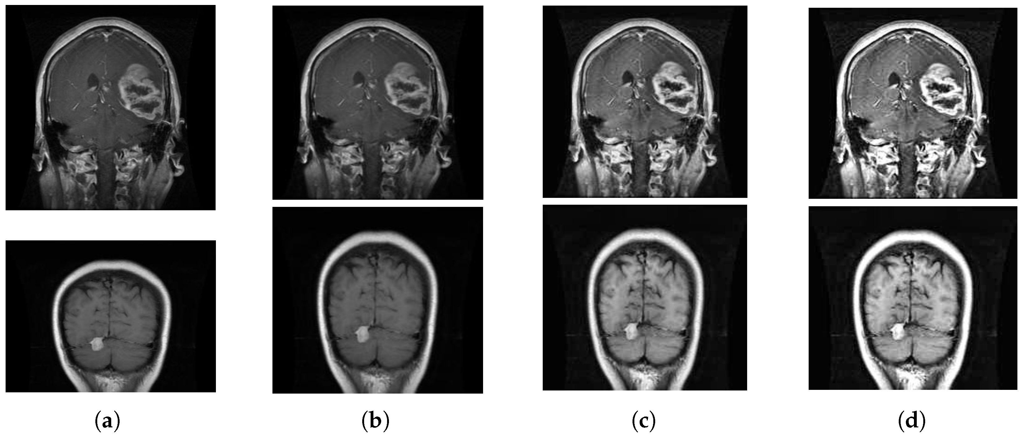 Deep Brain Tumor Lesion Classification Network: A Hybrid Method Optimizing ResNet50 and ...