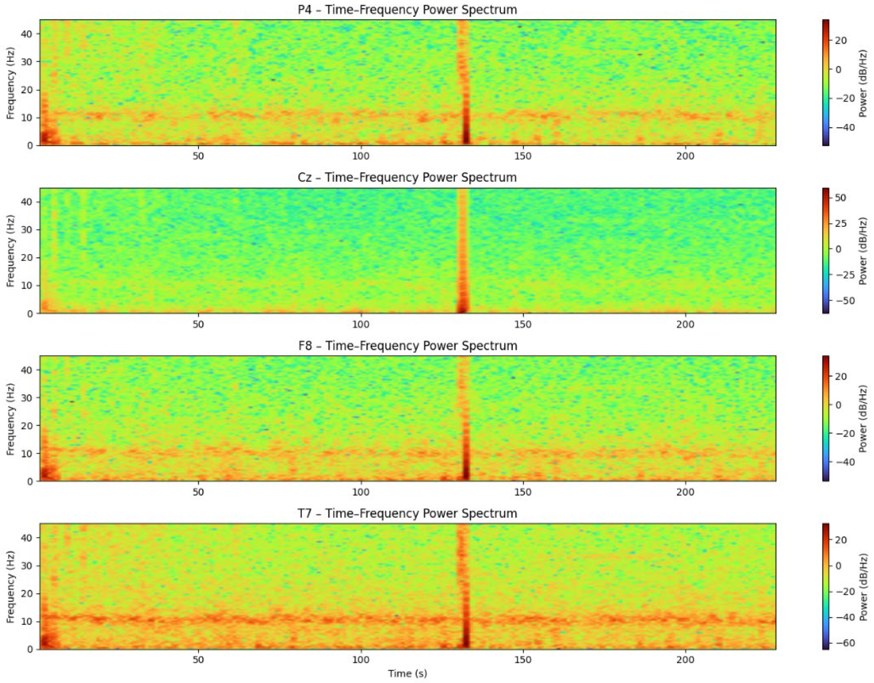 Fractal Analysis of Auditory Evoked Potentials: Research Gaps and ...