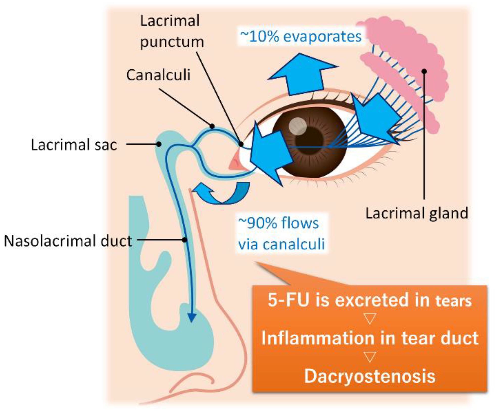 Synthesis and Evaluation of Carbon Black-Containing Hydrogels for the Adsorption of 5-Fluorouracil
