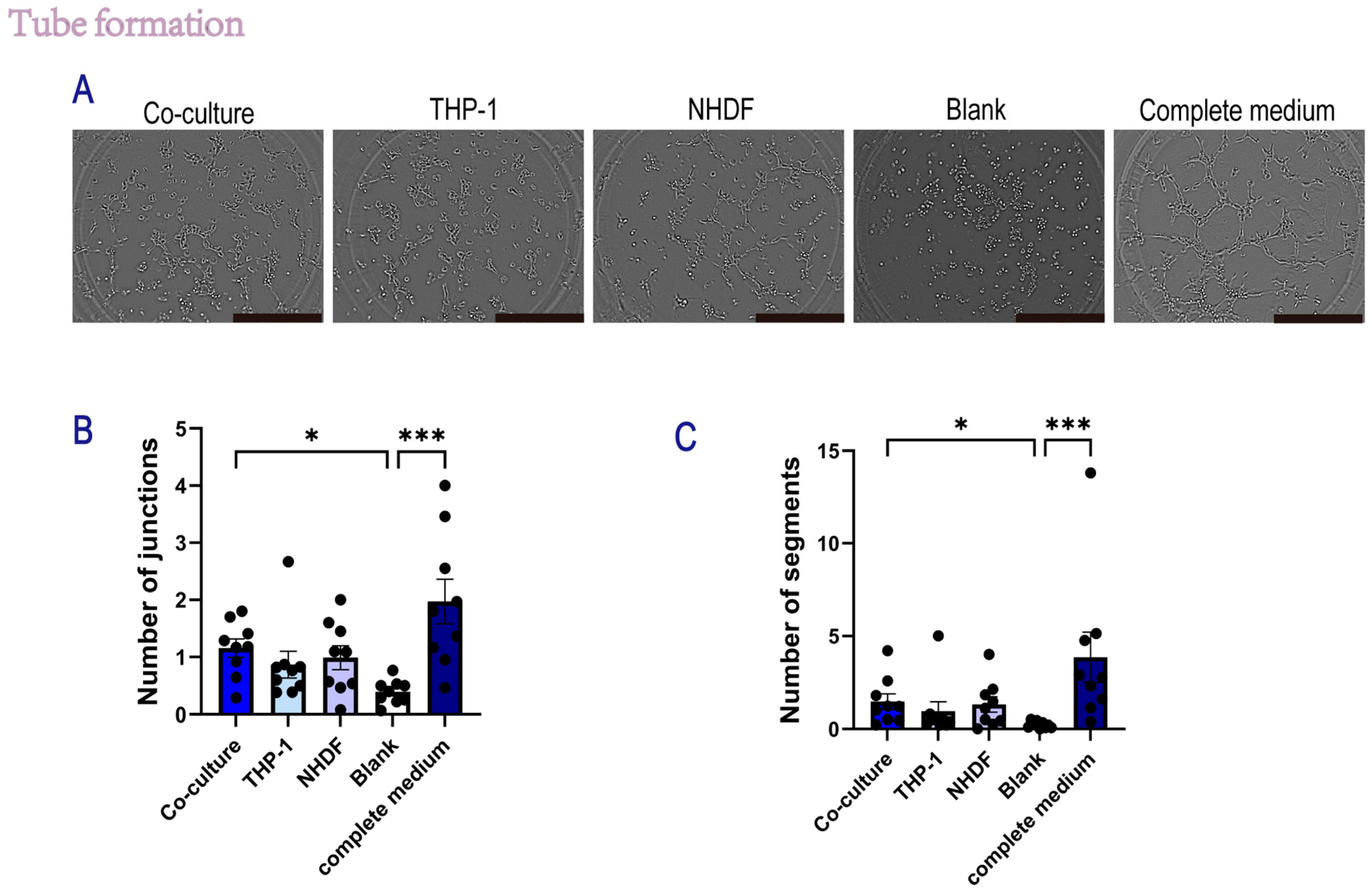 Dermal Fibroblasts Modulate Migration and Phenotype of Infiltrating ...